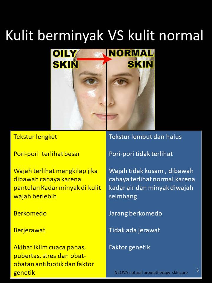 Kulit Normal VS Kulit Acne - Neova Online Academy